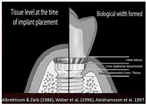 Soft Tissue Implant Integration (part 2)