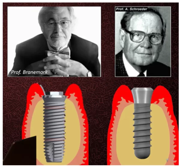 Soft Tissue Implant Integration (part 2)