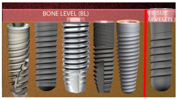 Soft Tissue Implant Integration (part 2)