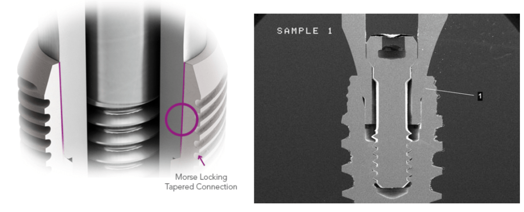 Comparison Of Implant/Abutment Connection Types