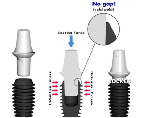 Comparison Of Implant/Abutment Connection Types