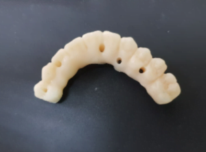 How To Choose The Right Multi-unit Abutments