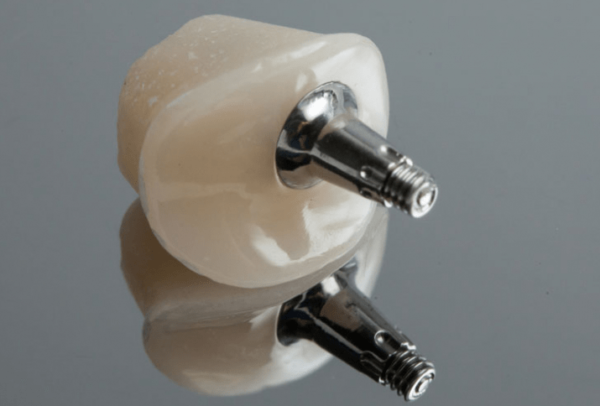 How To Select Abutment For Implant: A Comprehensive Guide