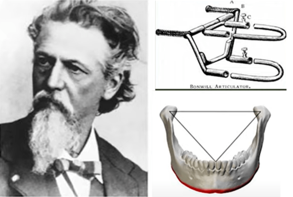History Of Implantology: Part II