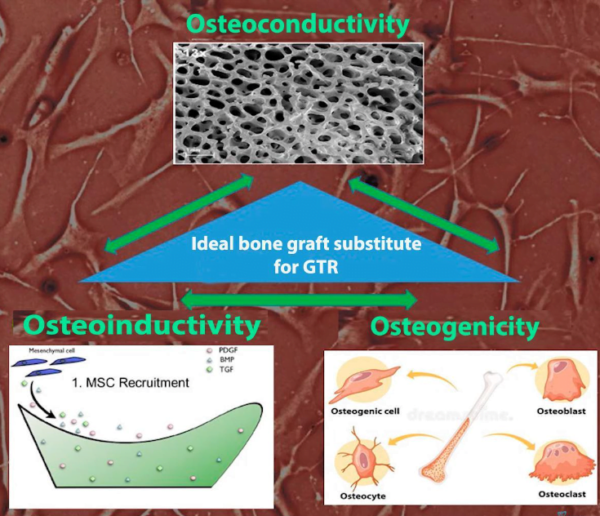Guided Bone Regeneration (GBR) Part 3 Allogenic And Xenogeneic And ...