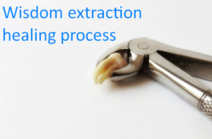 Wisdom Tooth Extraction: Understanding The Healing Process