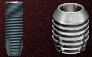 Subcrestal Implant Placement: Improving Soft Tissue Integration