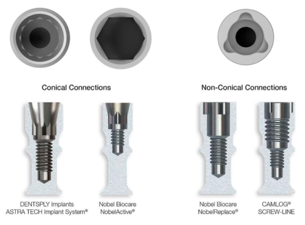 Screw-retained Vs. Cemented Restorations: Which Is Better?