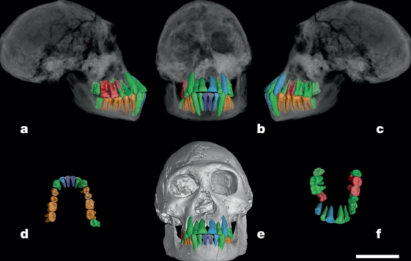Dental Evolution Research: Dmanisi Fossils Change Timeline