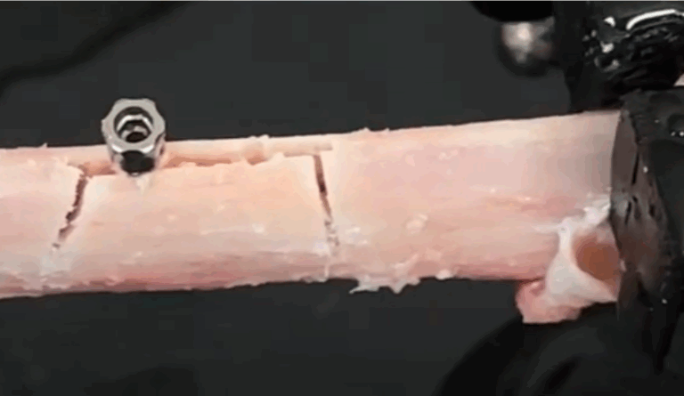 Ridge Split Technique: Implant Placement Protocol [Part 2]